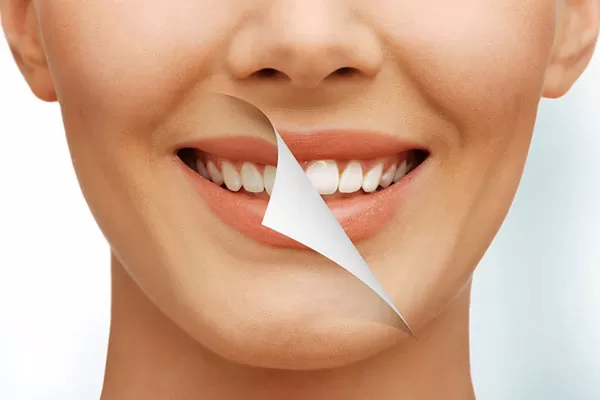 Asheville & Arden Bioclear | Asheville Smiles Cosmetic and Family Dentistry
